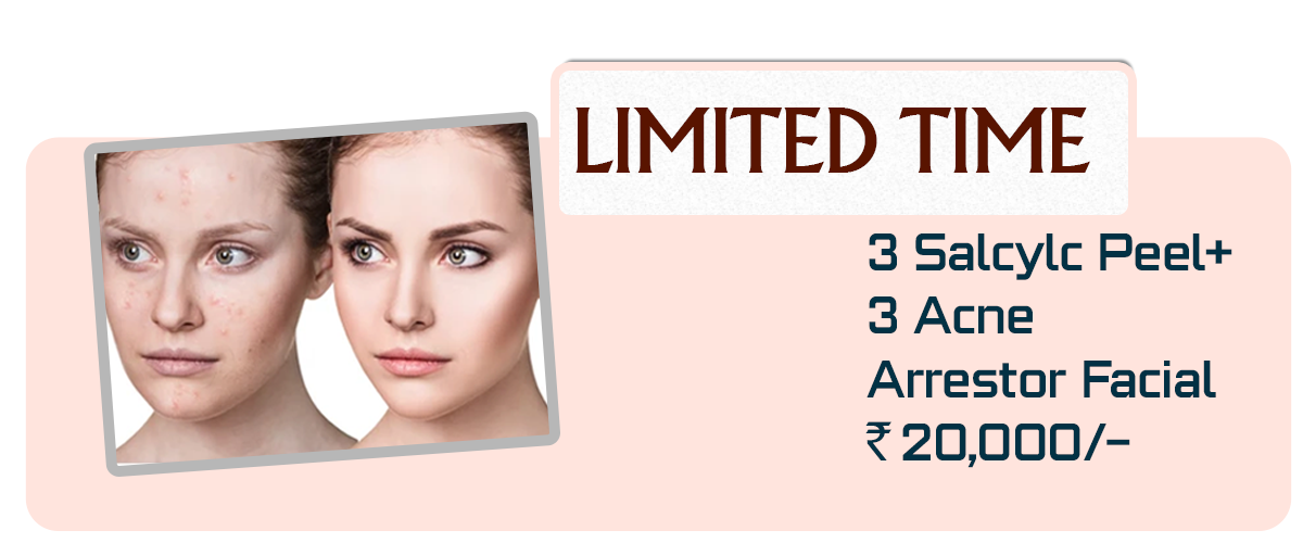 Salicylic Peel - Derma At Home